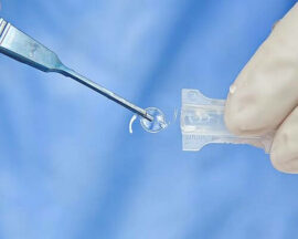 Cataract Surgery Orlando | Cataracts Winter Springs | Florida Eye